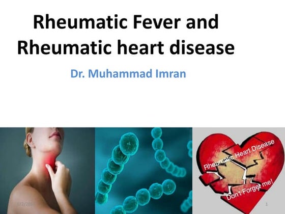 Rheumatic fever | PPT