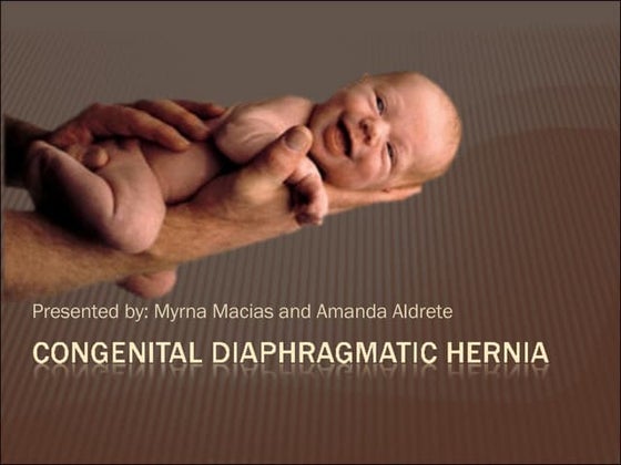 Diaphragmatic hernia | PPT