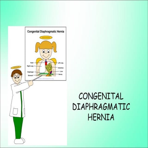 Congenital Diaphragmatic Hernia | PPT