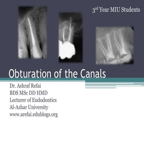 3rd year Obturation Lecture | PPTX