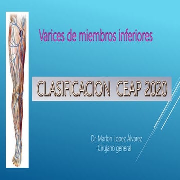 Clasificacion Ceap para varices | PPTX
