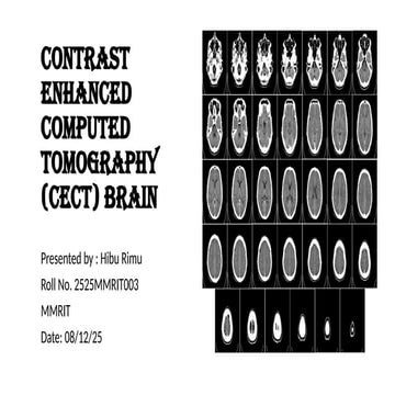 CPT And Diagnosis Codes For Bronchoscopies.pdf