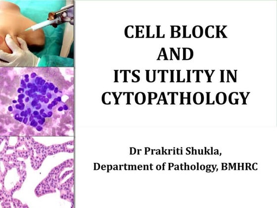 CELL BLOCK PREPARATION AND ITS IMPORTANCE | PPTX