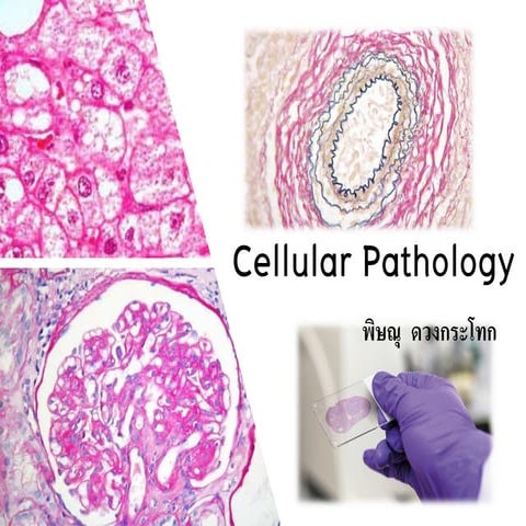 Cellular Pathology พิษณุ ดวงกระโทก.pdf