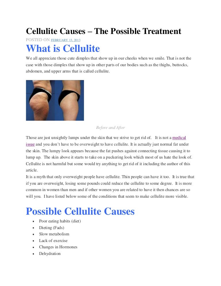 Cellulitis Causes