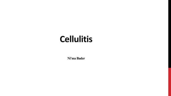 Cellulitis | PPTX