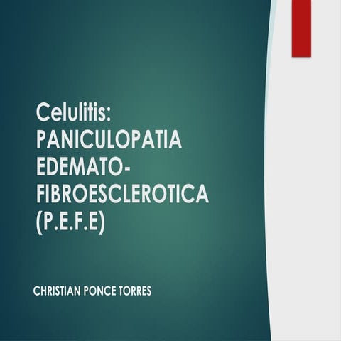 La celulitis | PPTX