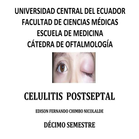 Celulitis postseptal (orbitaria final | PPT