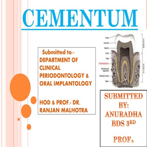 Cementum | PPT