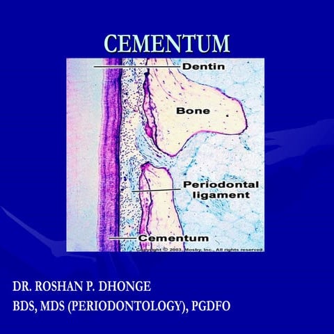 CEMENTUM Powerpoint 2025 important reas it | PPT