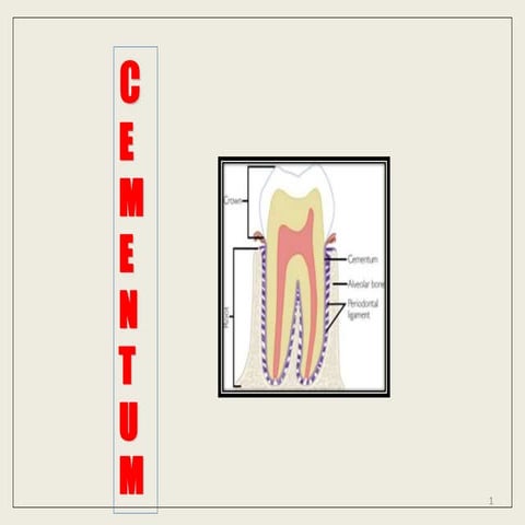 Cementum | PPT