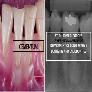 cementum detailed histology and types .pdf