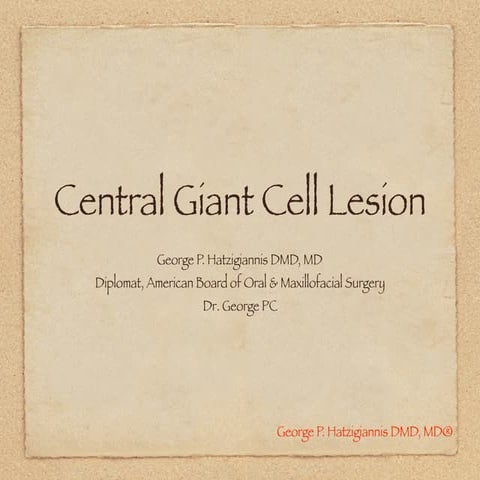 Central giant cell granuloma | PPTX