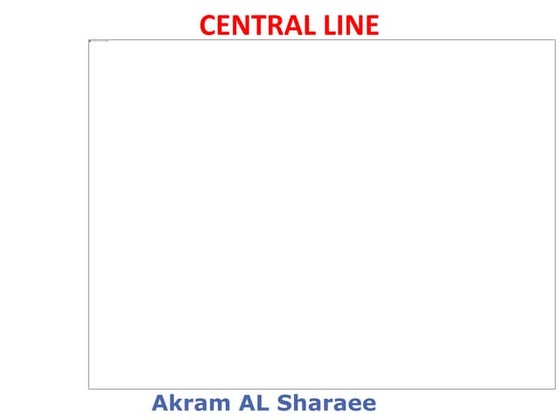 Central line | PPTX
