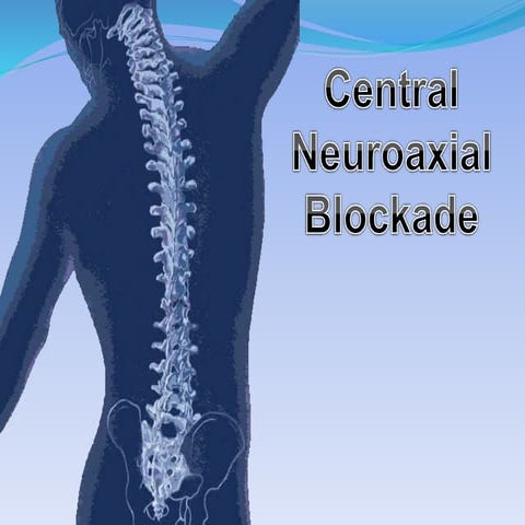centralneuroaxialblockadembbs-pranav-.ppt
