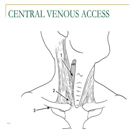 anatomical review of internal jugular vein cannulation.pptx