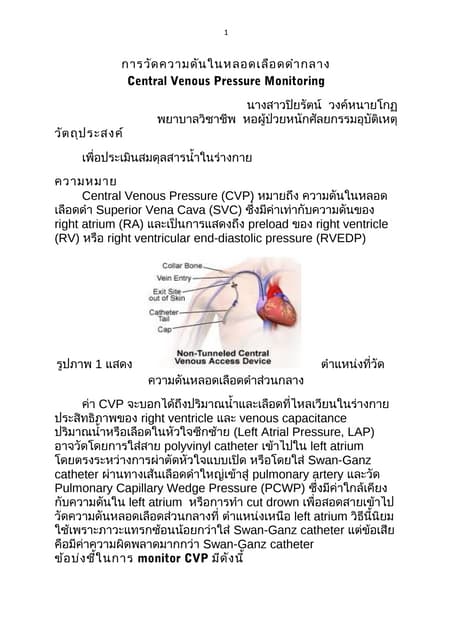 Chest drain systems | PDF