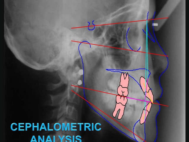 Downs analysis in orthodontics (Nay Aung, PhD).pdf