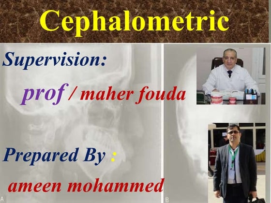 Cephalometrics ( landmarks,Lines and Planes ) | PPTX | Ear, Nose and ...
