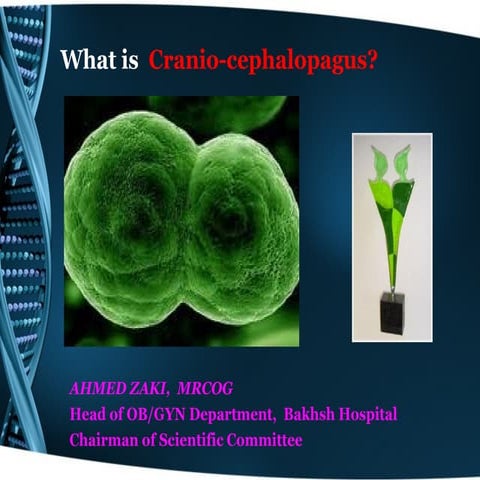 cranio-Cephalopagus | PPT