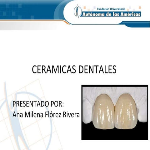 Ceramicas dentales biomateriales | PPTX
