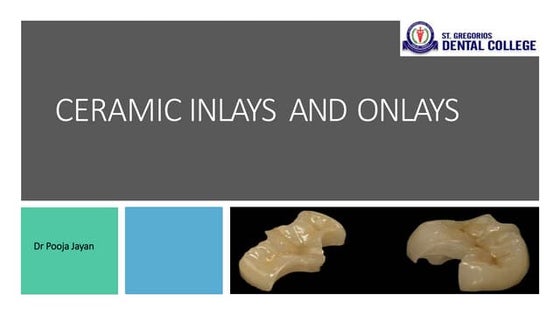 indirect restorations | PPT