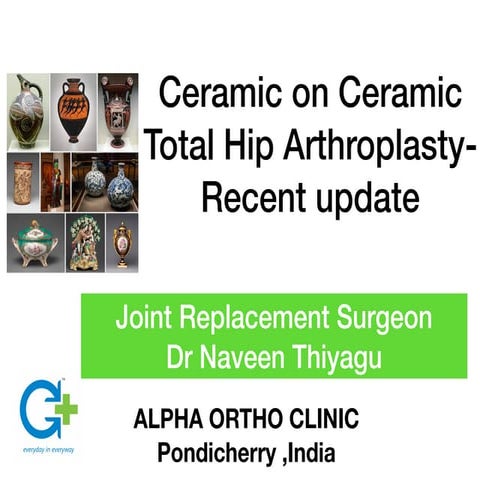 Ceramic on Ceramic in Total Hip Replacement | PPT | Free Download