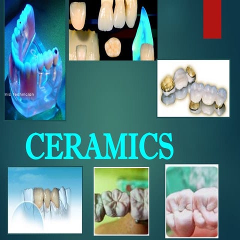ceramics in dentistry,classification,techniques | PPT