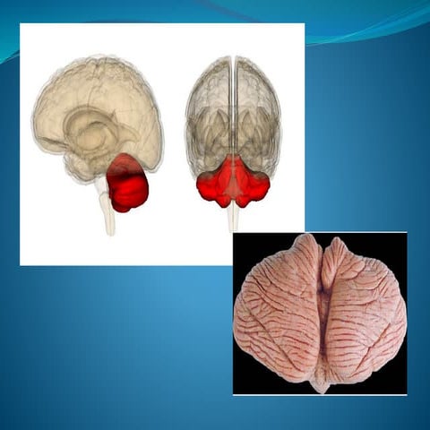 Cerebellar Vermis Sagittal View
