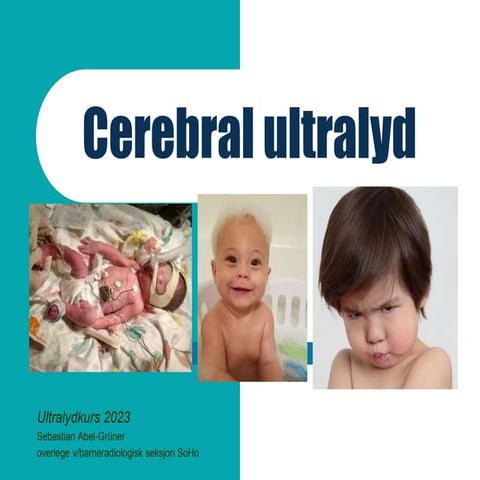 Cerebral ultralyd | PPT