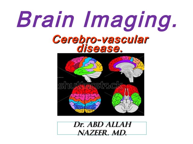Imaging of Non Traumatic Intracranial Bleeding.pptx