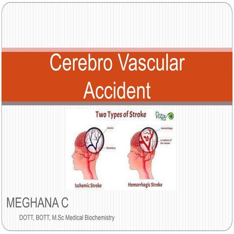 Cerebro vascular accident | PPTX
