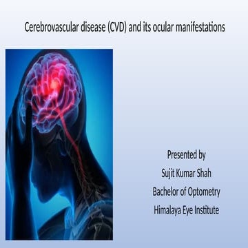 Cerebrovascular Disease By Sujit Pptx