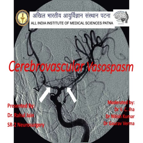 Cerebrovascular Vasospasm - Etiopathogenesis and Management | PPTX