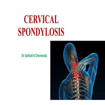 Cervical Spondylosis | PPT