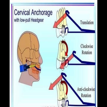 CERVICAL ANCHORAGE.pptx