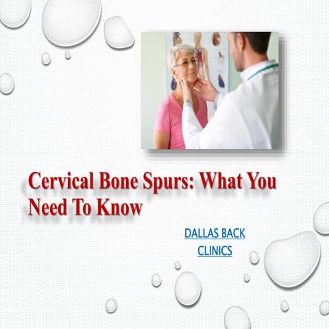 Cervical Bone Spurs - What You Need To Know | PPTX