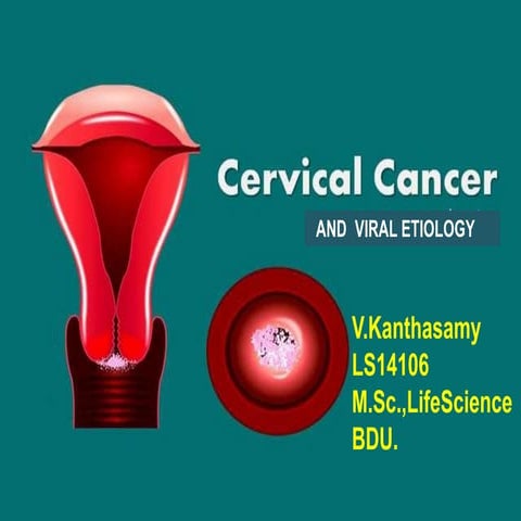 Cervical cancer and viral etiology | PPTX