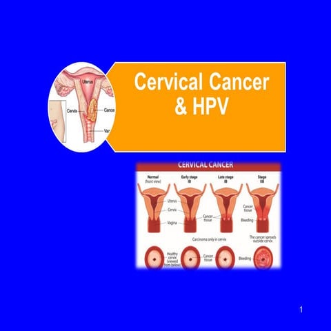 Cervical cancer hpv | PPT