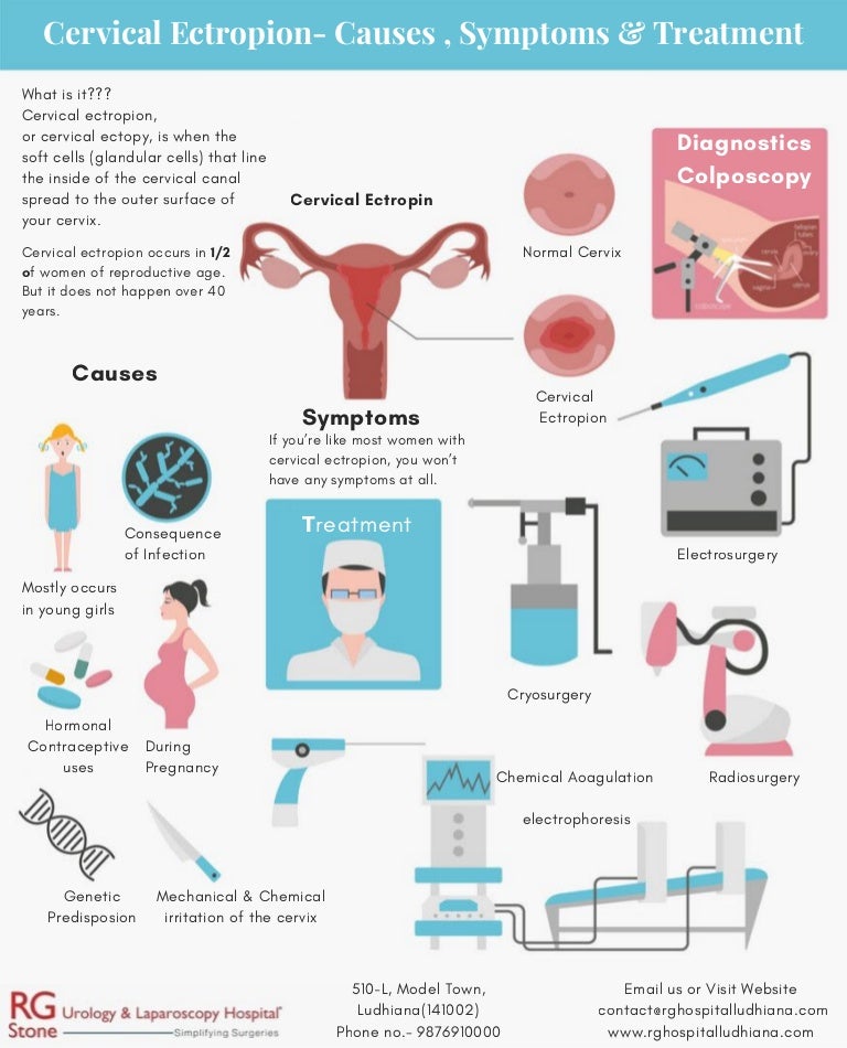 Cervical Ectropion Causes Symptoms Cervical Ectropion