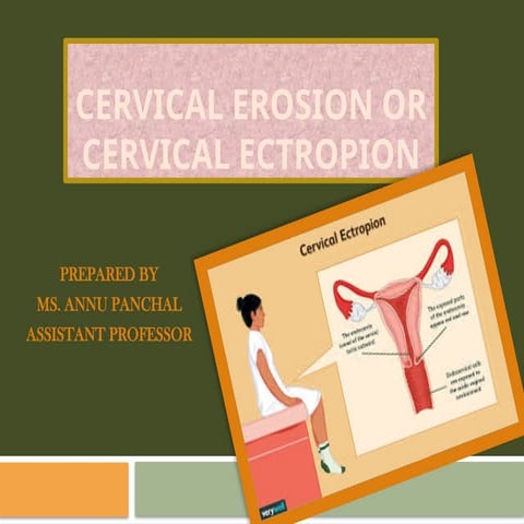 CERVICAL EROSION.ppt for the nursing students | PPTX