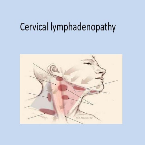 Cervical lymph nodes | PPTX