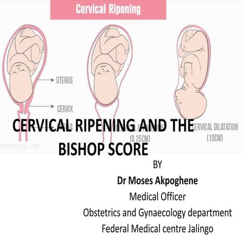 Breech Obstetrics. | PDF