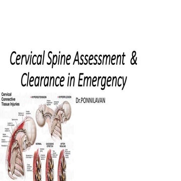 Cervical spine clearance in polytrauma | PPTX