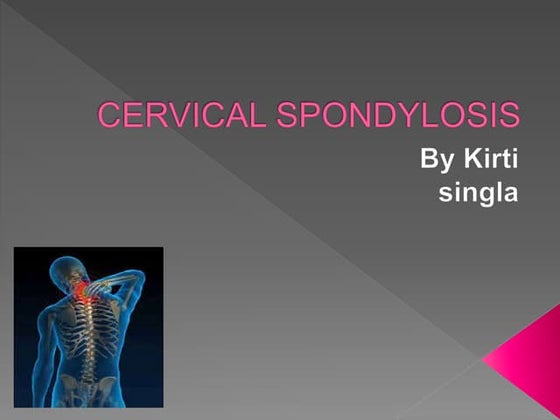 Spondylosis | PPTX