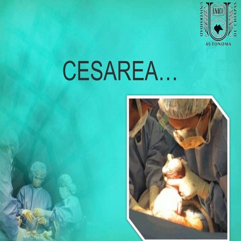 Cesárea Pptx