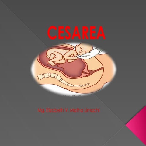 CESAREA una guia para enfermeria2022.pptx