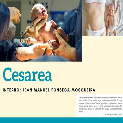 Cesarea en medicina cesarea en medicinaa | PDF