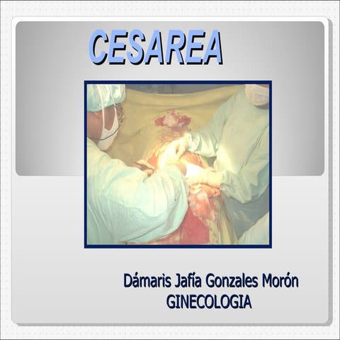 Cesarea Abdominal Pptx
