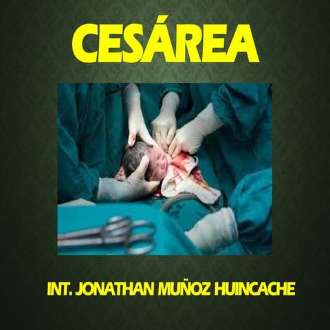 Cesarea | PPTX